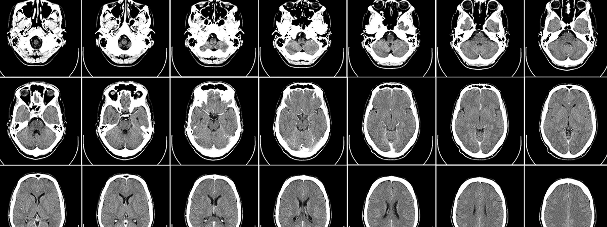 El Covid impulsa las soluciones de patología digital en los hospitales