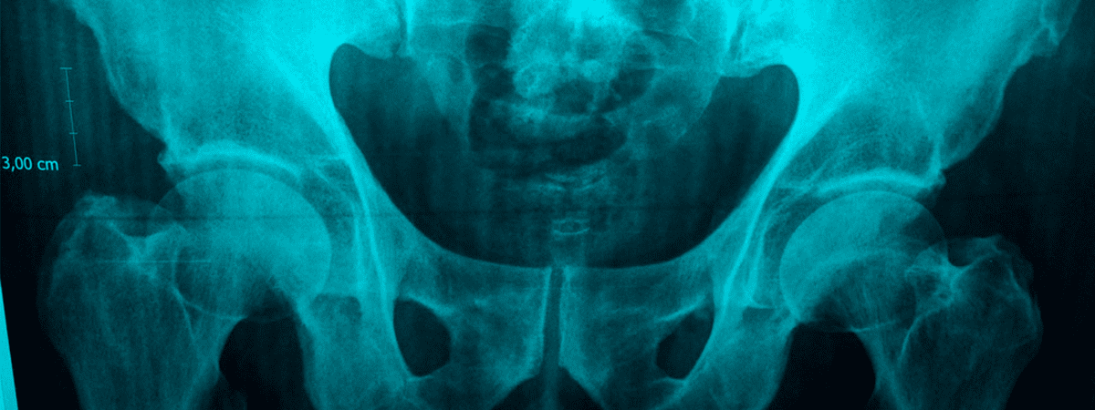 Los primeros datos del Registro REFRA-FLS avalan el modelo de éxito de ...