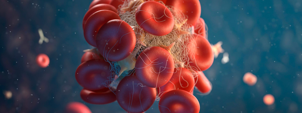 Tras la pista de la predisposición genética a la PTI en el adulto